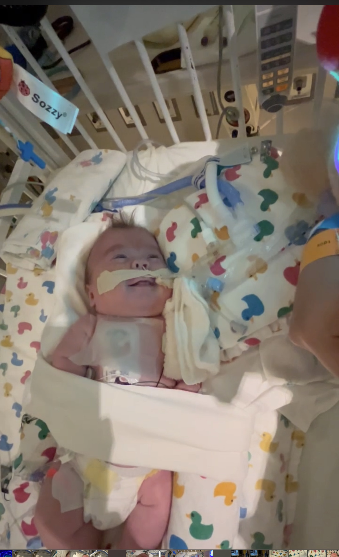 Soft Bones – Hypophosphatasia (HPP) Resources