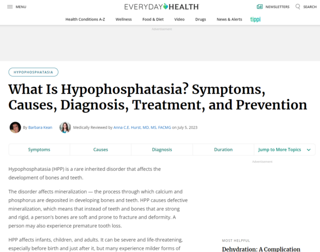 What is Hypophosphatasia? Symptoms, Causes, Diagnosis, Treatment and ...