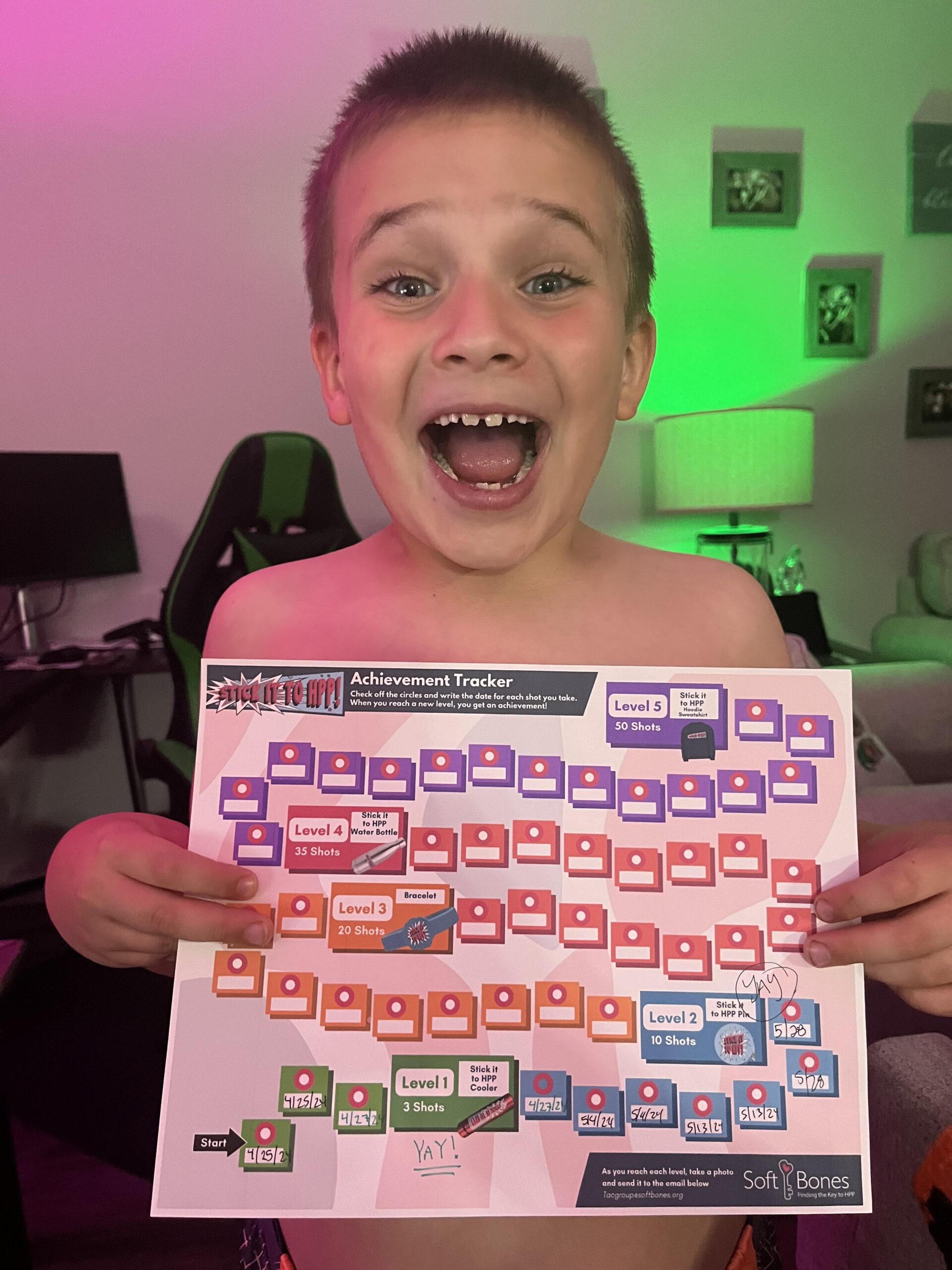 Patient of the Month- Jaycob B. – Soft Bones